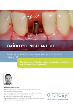 Calaméo - Axiom® Concept - The advantages of dental implant with ...