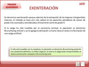 Calaméo - EXENTERACION