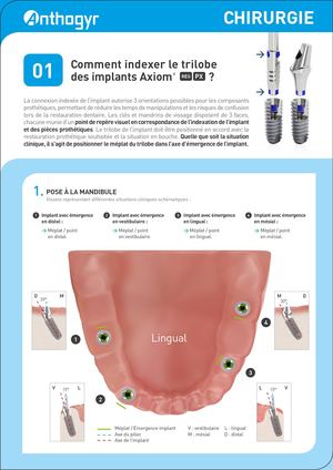Calaméo - Indexation trilobe implants Axiom® REG/PX Anthogyr