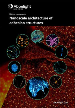 Calaméo - Abbelight App Note Adhesion Structures SMLM V2