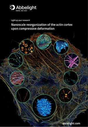 Calaméo - Abbelight App Note Nanoscale Reorganization Of The Actin ...